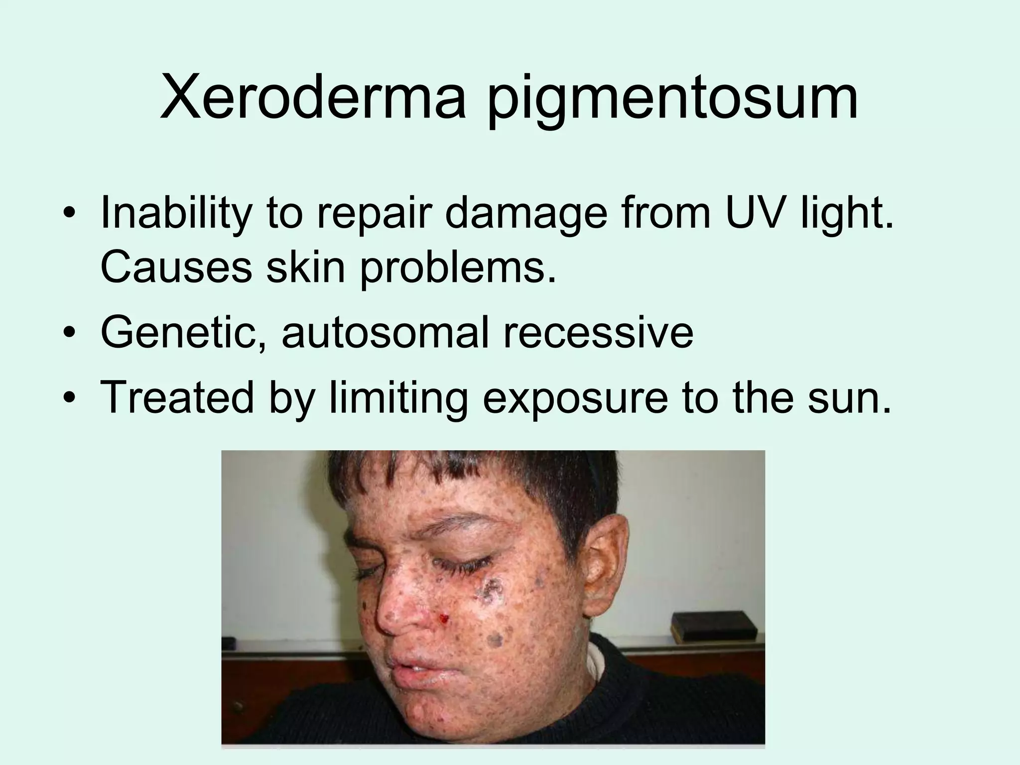human_genetic_disorders.ppt | Physical Therapy | Wellness