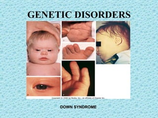 Human Genetic Anomalies