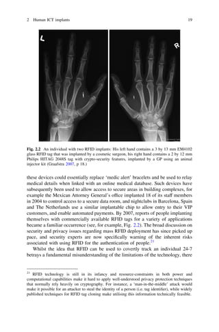 Human ict implants from restorative | PDF