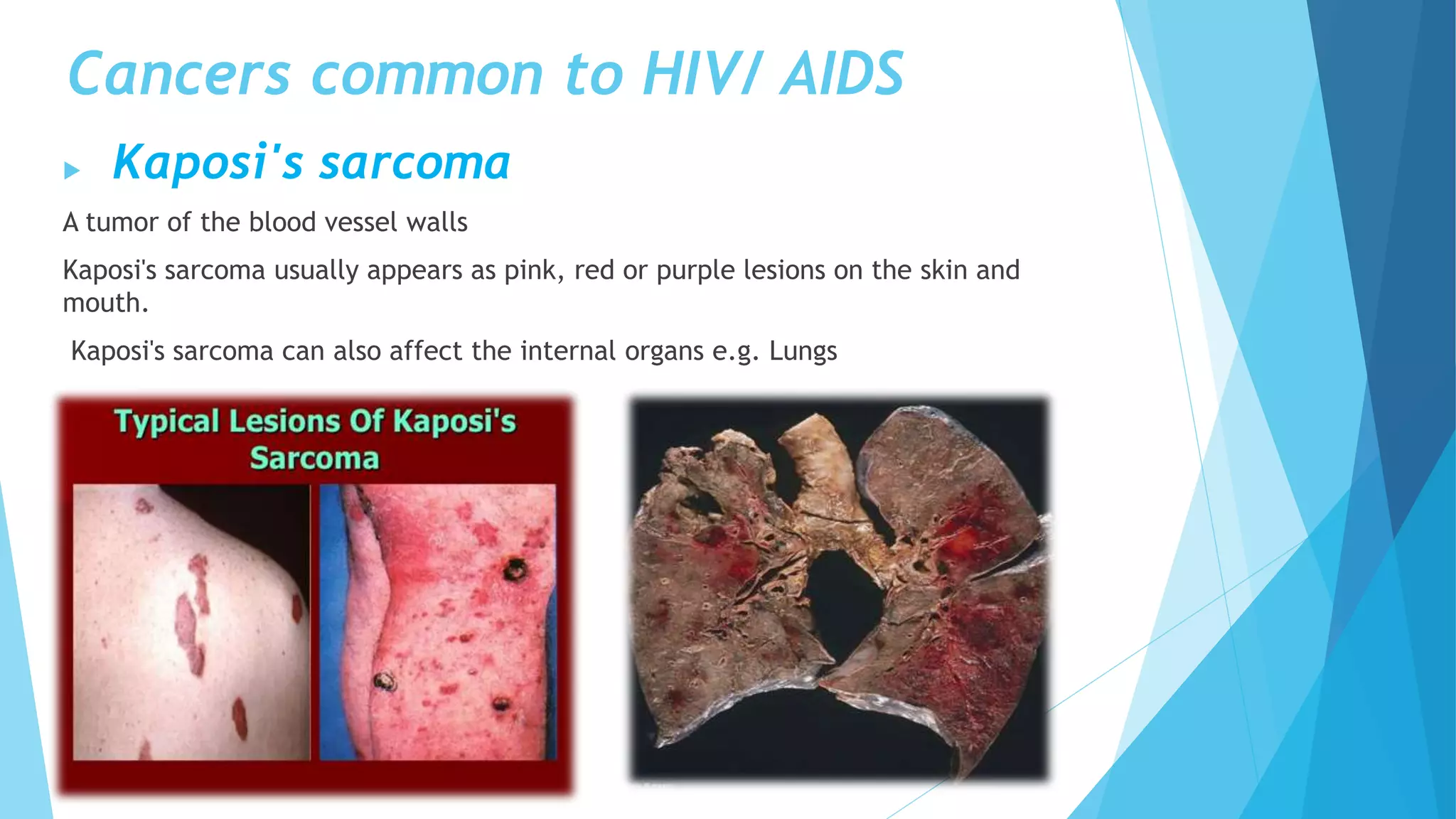 Human immune deficiency syndrome | PPTX