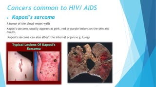 Human immune deficiency syndrome | PPTX