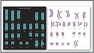 Human Karyotype: Decoding Our Chromosomal Makeup and Its Clinical ...