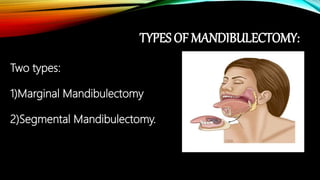Human mandible | PPT