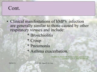 Human metapneumovirus | PPT