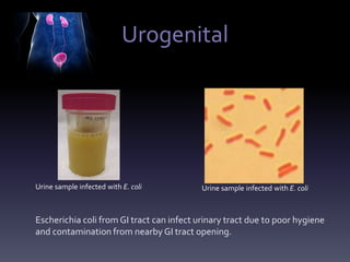 Human microbiota | PPT