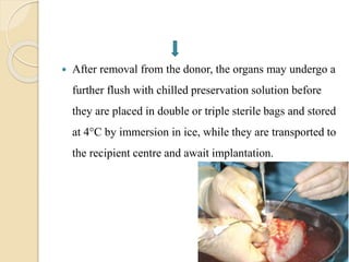 Human Organ Transplantation Act In Bangladesh And Cadaveric CME.pptx
