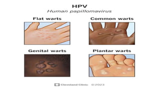 HUMAN PAPILLOMAVIRUS (HPV).pptm.pptx2024 | PPTX