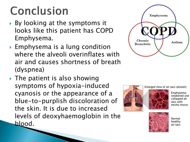 Human Physiology Case Study 1 complete.pptx