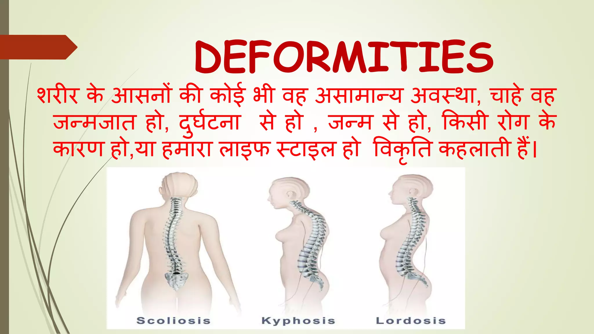 Human Postural Deformities Corrected by Yoga. | PPT
