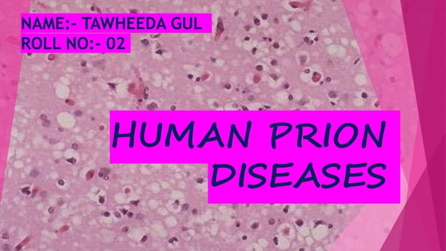 HUMAN_PRION_DISEASES[ A component in virology1].pptx