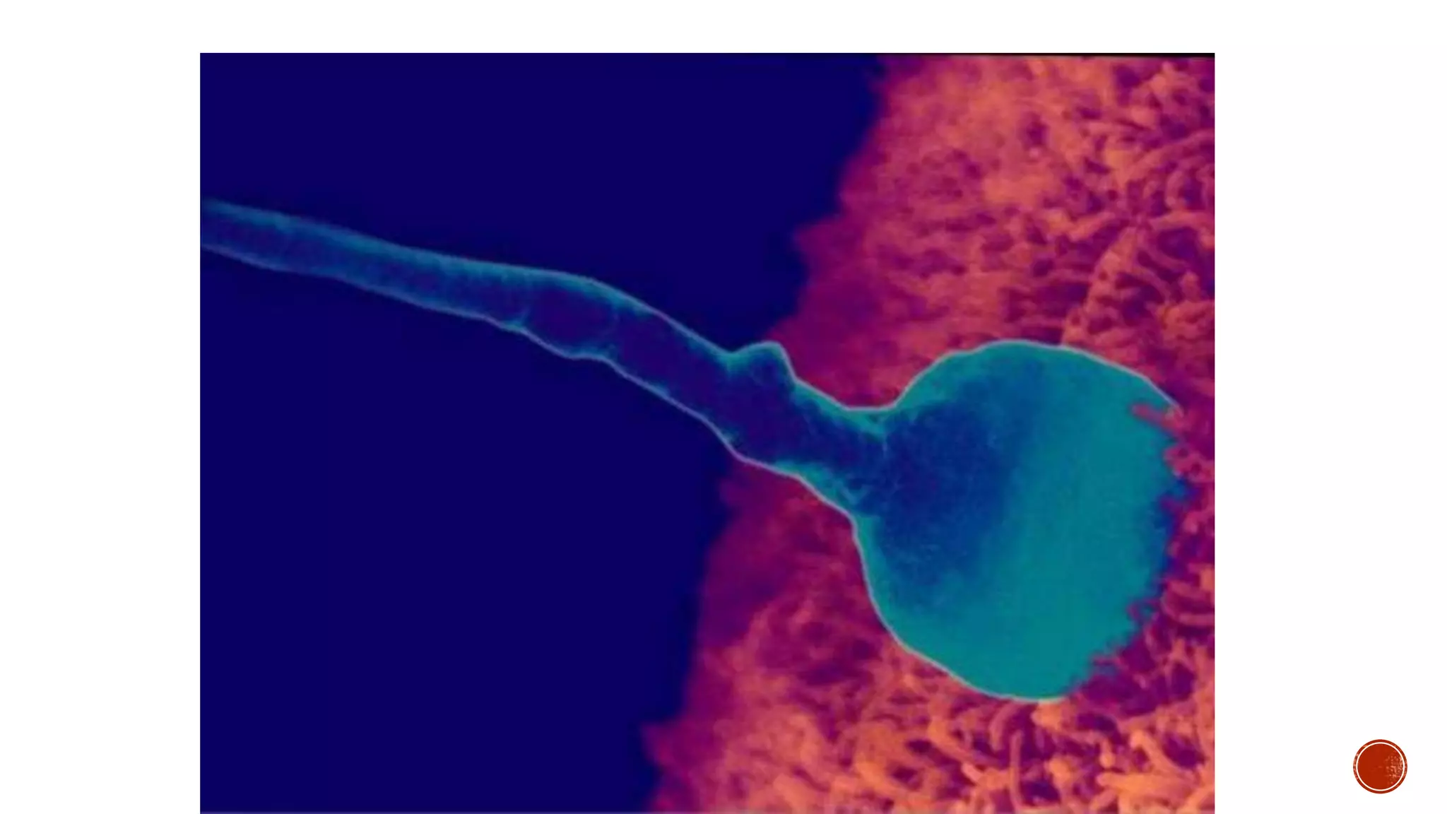 Human reproduction Complete Chapter | PPTX