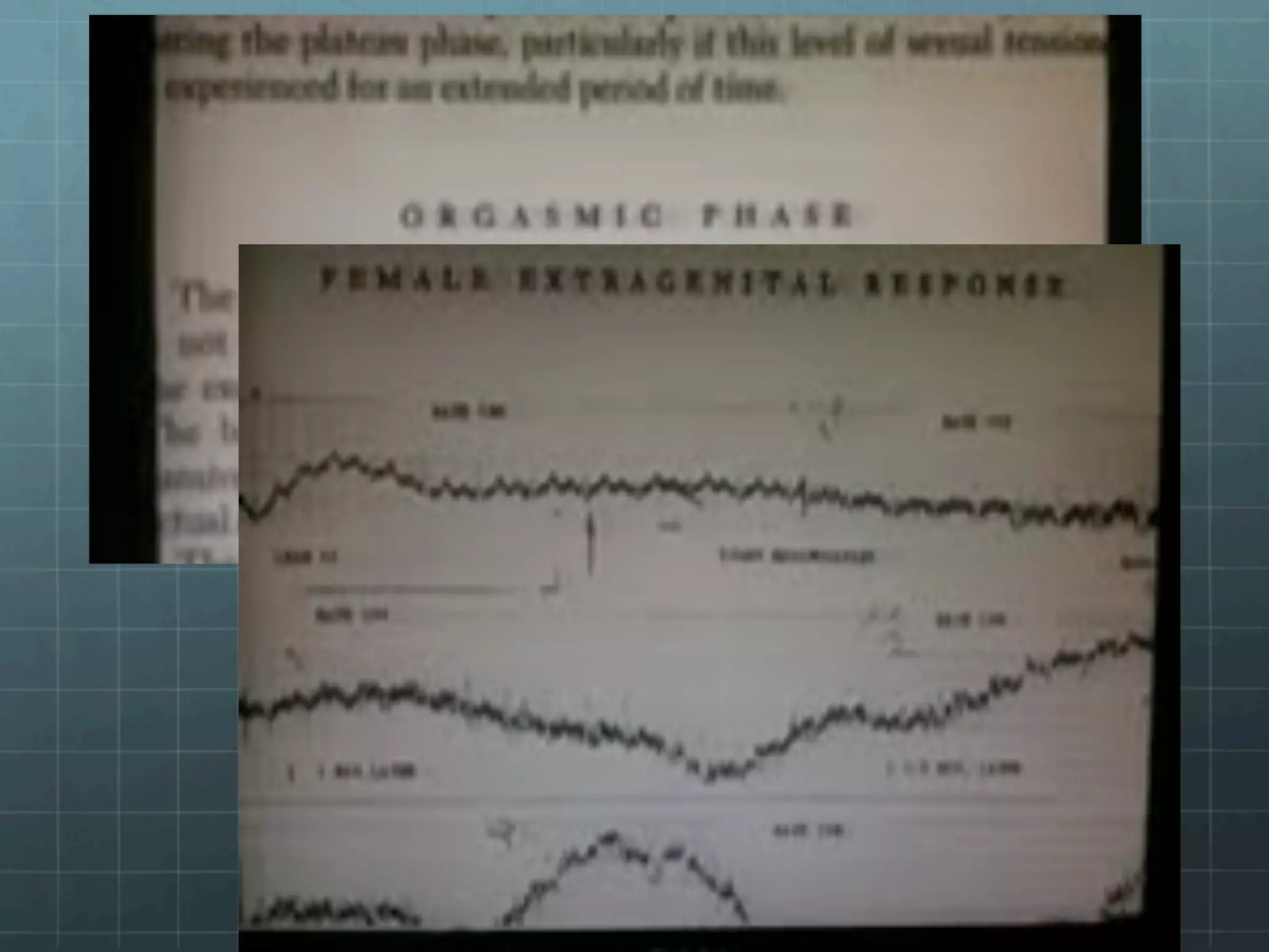 Human Sexual Response Nw Pdf Sexual Conditions Sexual Health