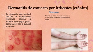 Human Skin Disease Atopic Dermatitis by Slidesgo.pptx
