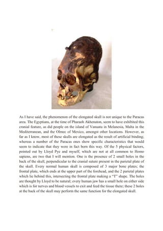 Human skulls of peru possible evidence of a lost human species | PDF