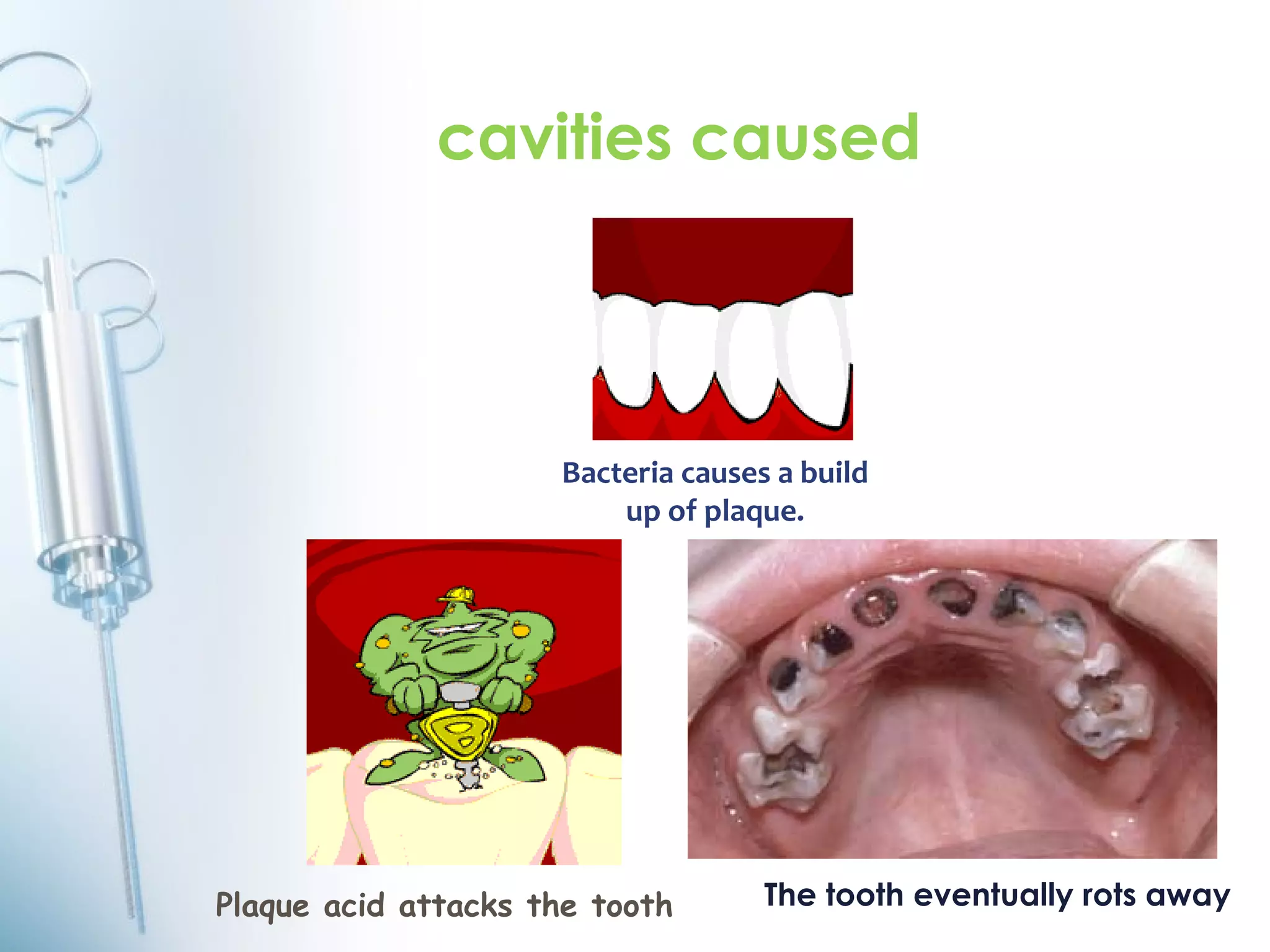 Human teeth 2 | PPT