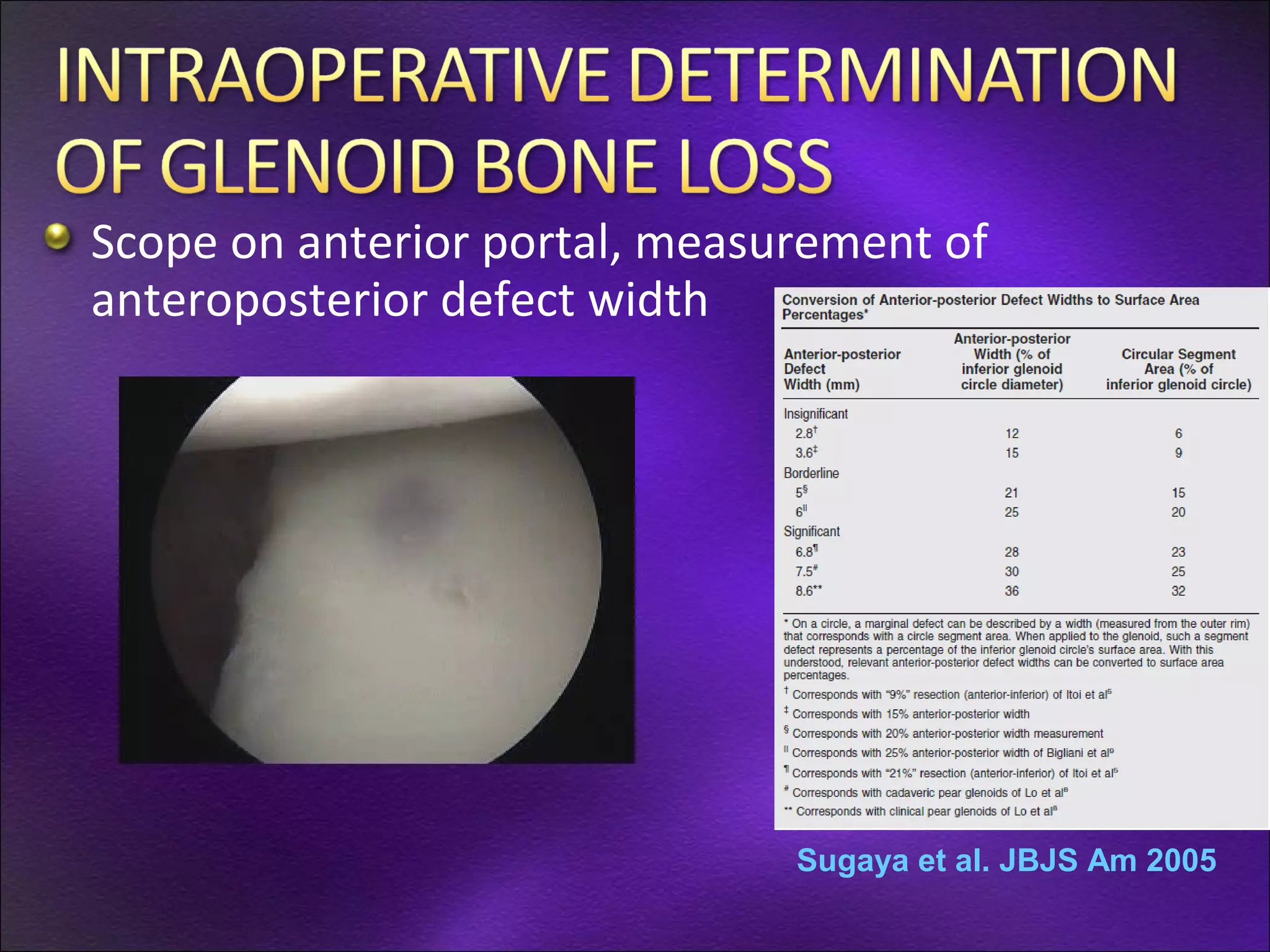 Humeral and glenoid bone defects as factors | PPT