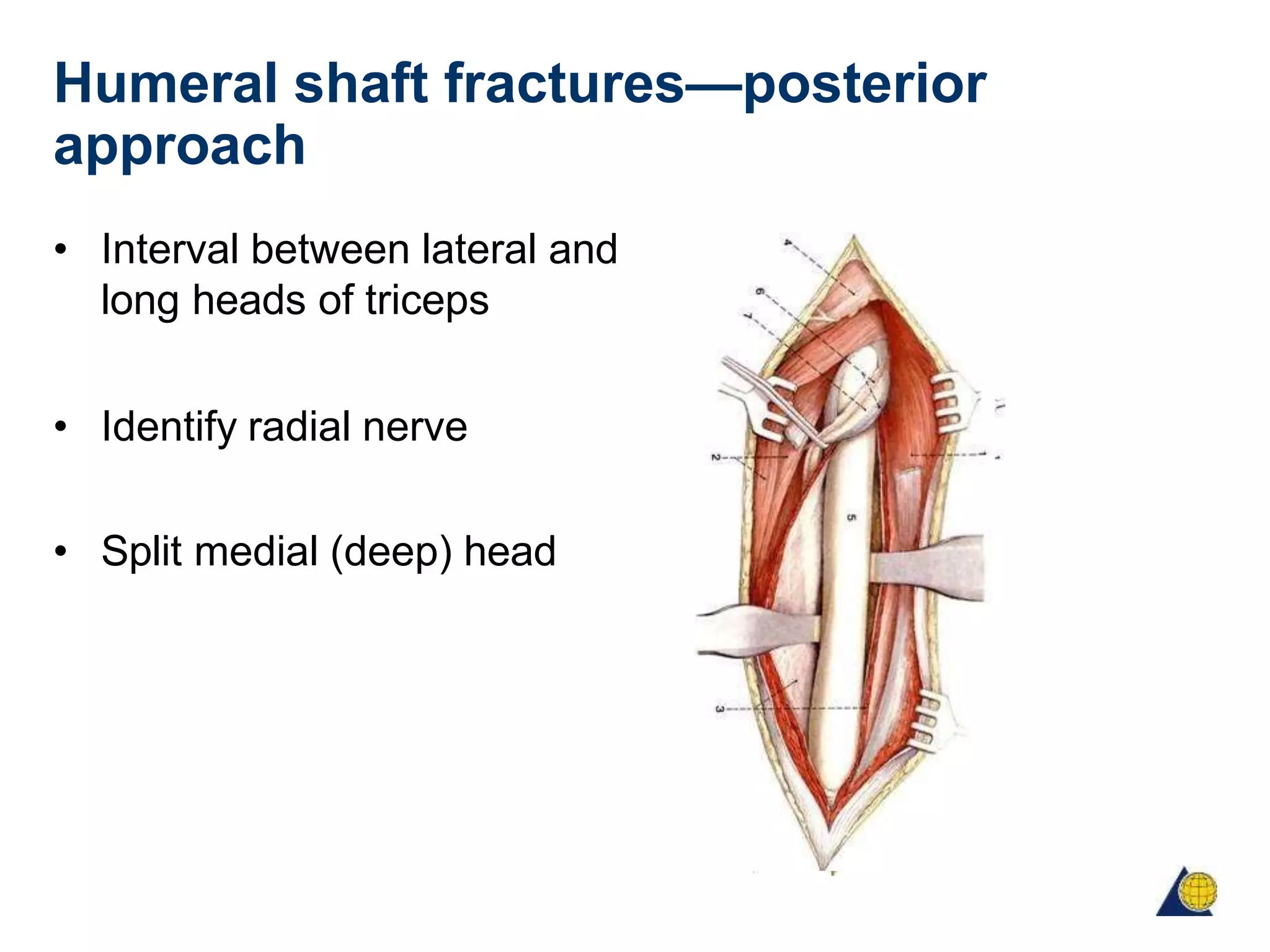 humerus shaft | PPTX