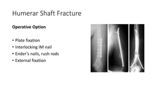 Humeral Shaft Fracture.pptx
