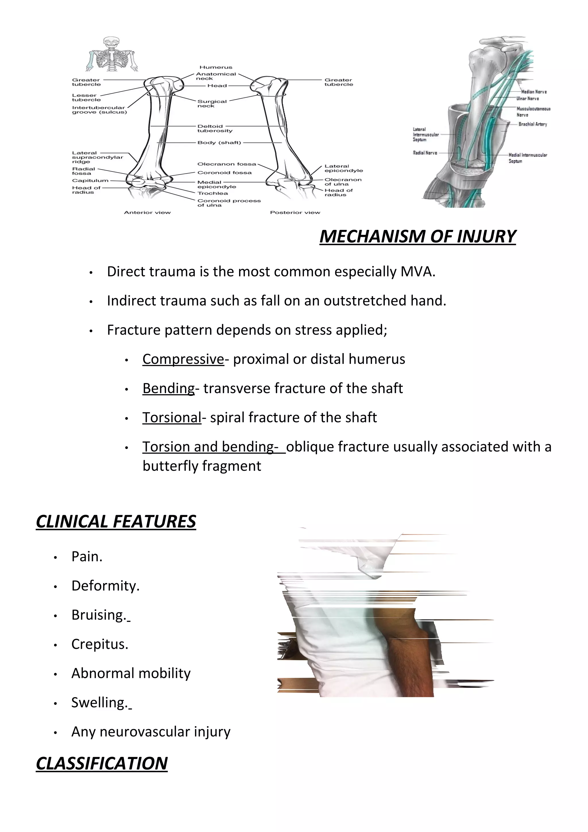 Humeral shaft fractures | ODT