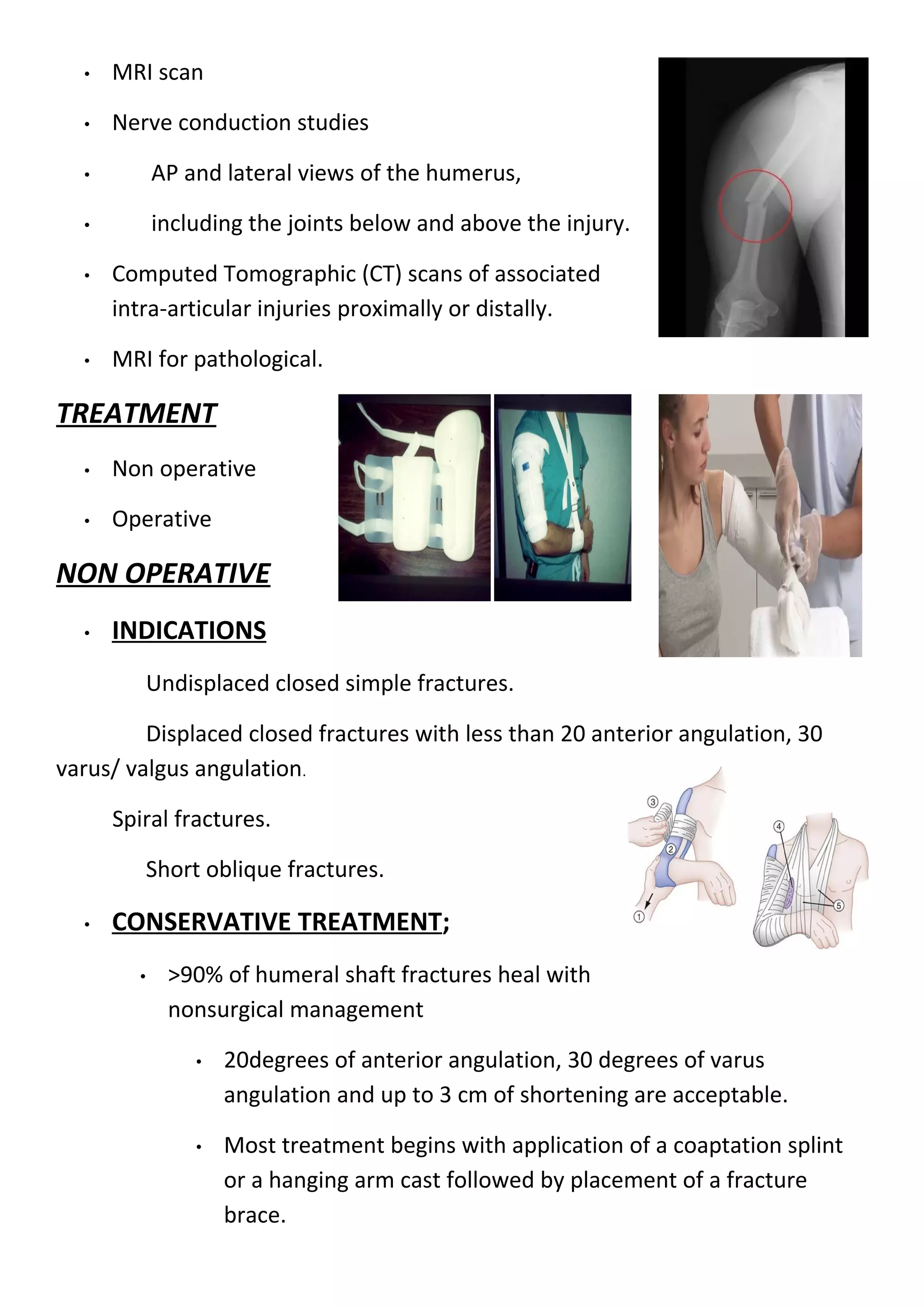 Humeral shaft fractures | ODT