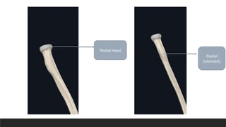 Humeroradial and Humeroulnar joints.pptx
