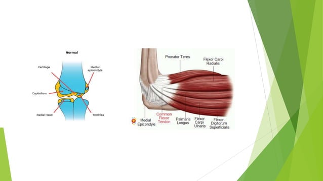 Anatomy of Humerus | PPTX