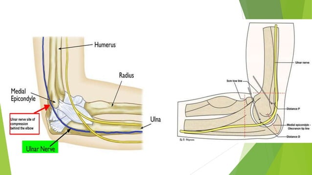 Anatomy of Humerus | PPTX