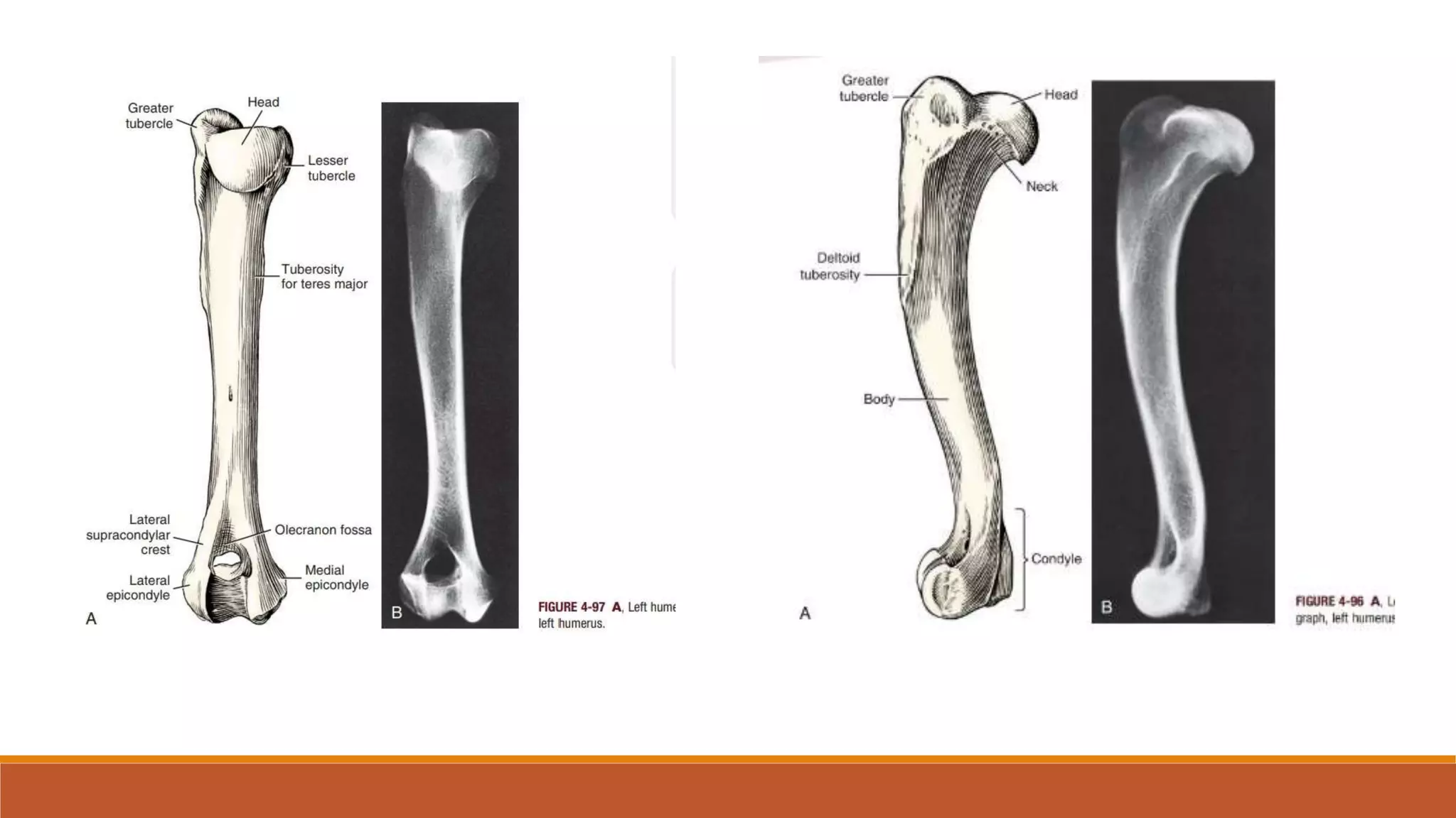 humerus anatomy of domestic animals | PPTX