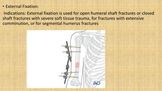 Humerus fracture | PPTX