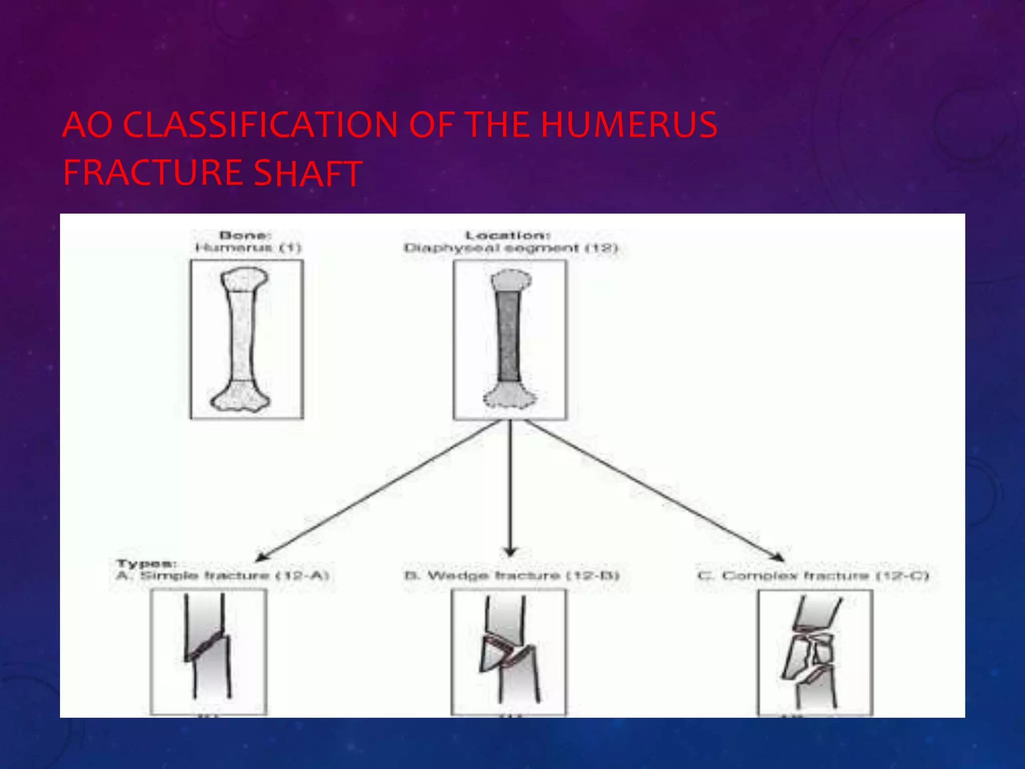 Humerus shaft fracture dr anand | PPTX
