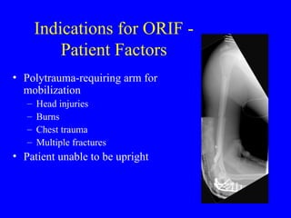 Humerus_fractures_management_and_outcomes.ppt