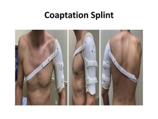 Humerus Shaft Fractur-OSCE.pptx