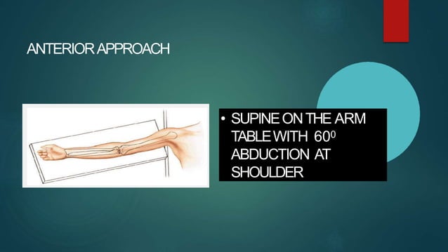 Humerus shaft fracture and elbow dislocation by dr ashutosh | PPT
