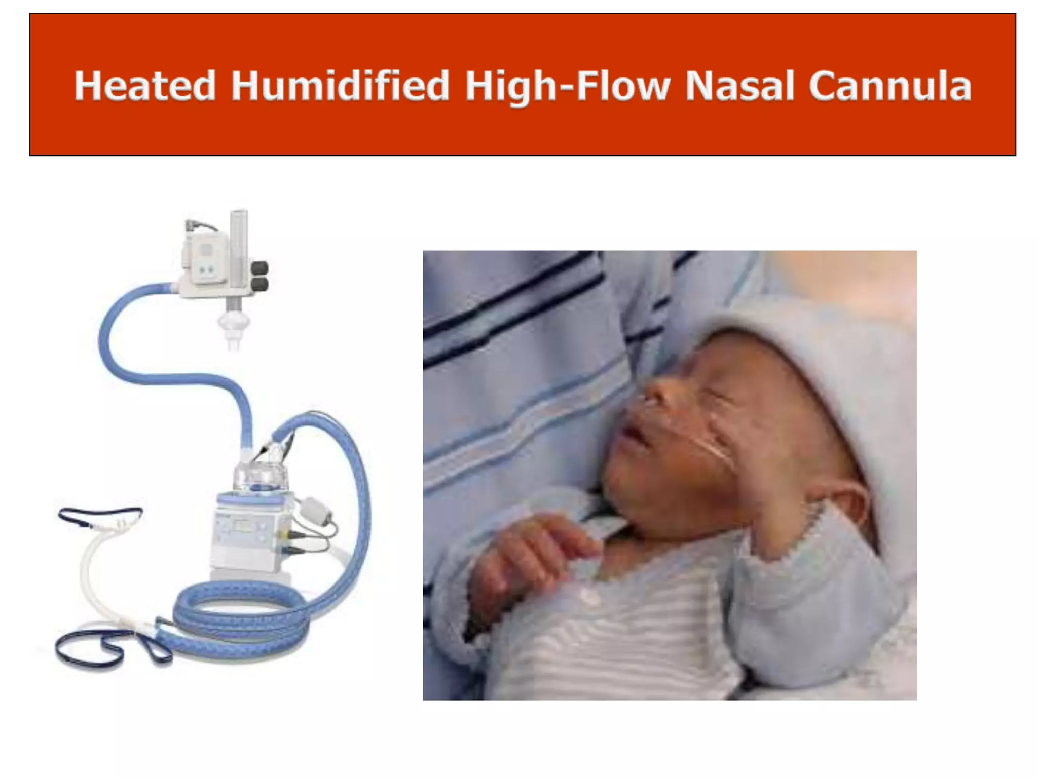 Humidfied nasal cannula | PPT
