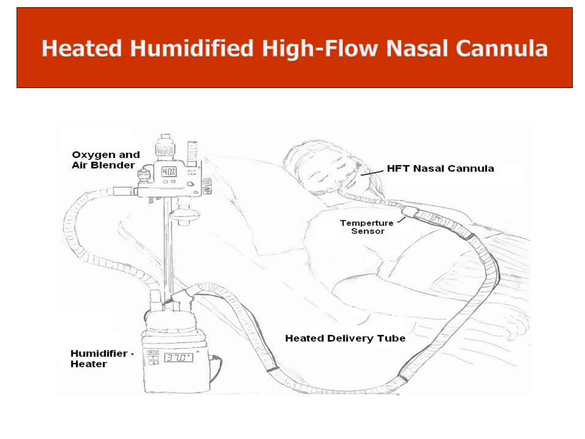 Humidfied nasal cannula | PPT