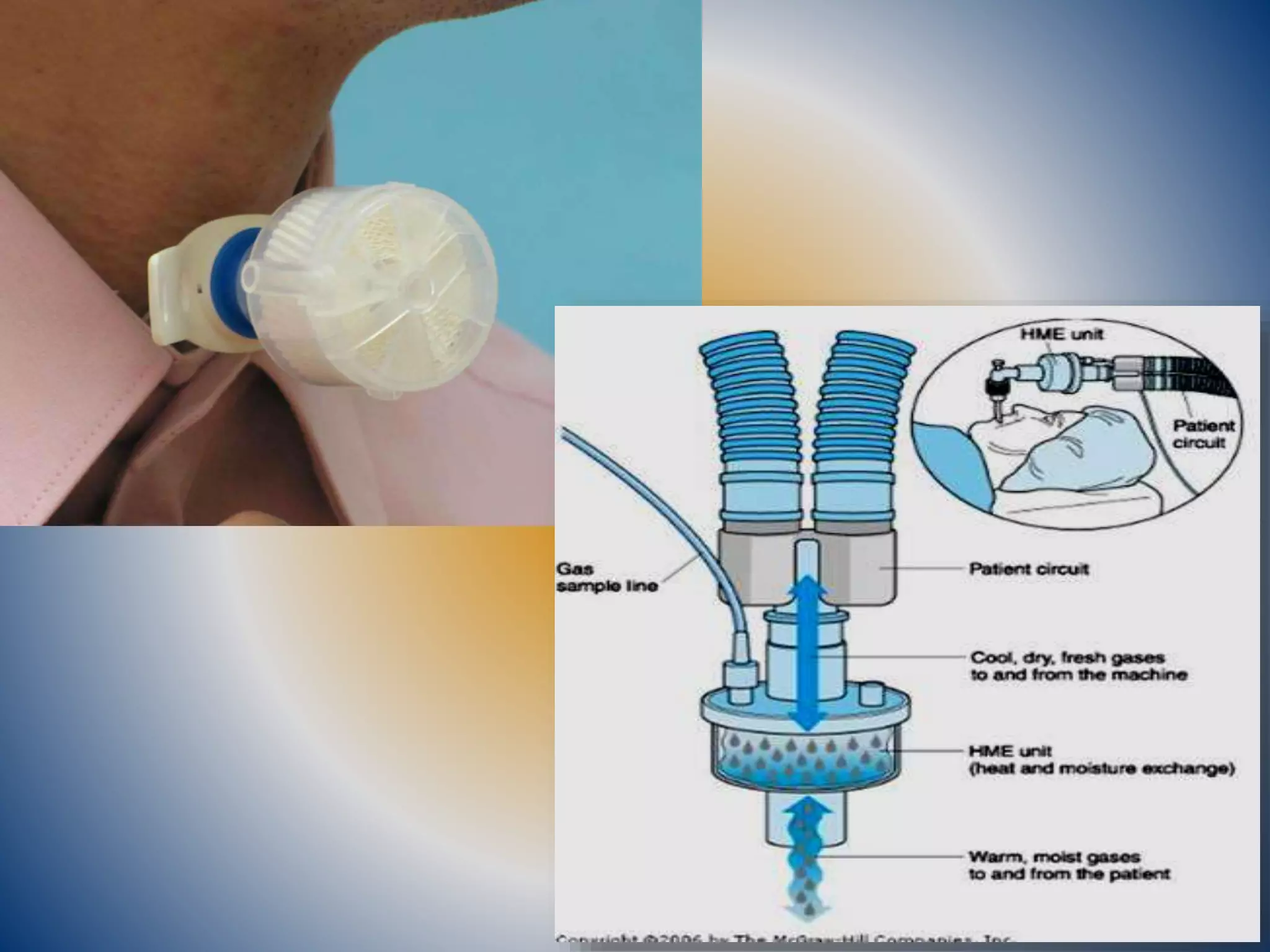 Humidification in Anaesthesia | PPTX