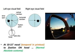 Humphery perimetry interpretation (part1) | PPTX