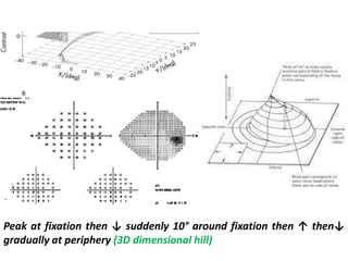 Humphery perimetry interpretation (part1) | PPTX