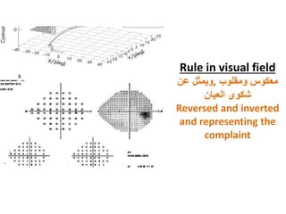 Humphery perimetry interpretation (part1) | PPTX