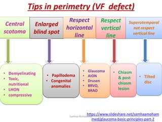 Humphery perimetry interpretation (part2) | PDF
