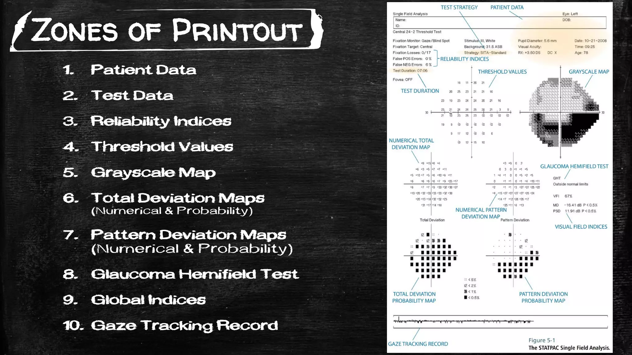 Visual Field | Humphrey Perimetry | PDF