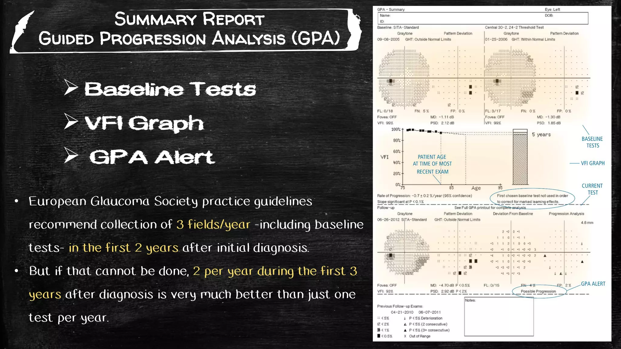 Visual Field | Humphrey Perimetry | PDF