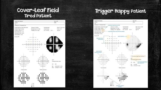 Visual Field | Humphrey Perimetry | PDF | Eye and Vision Conditions ...
