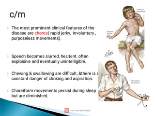 huntington disease presentation by archana.pdf