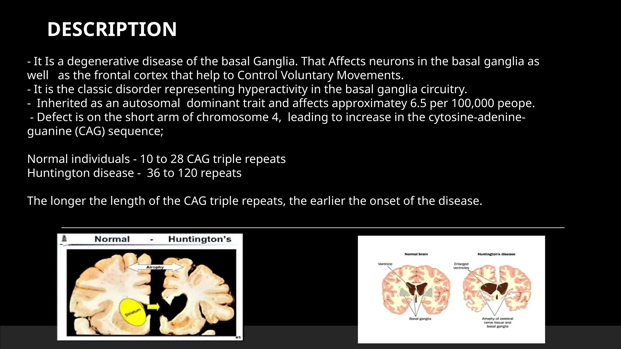 Huntington's chorea case coordination .pptx
