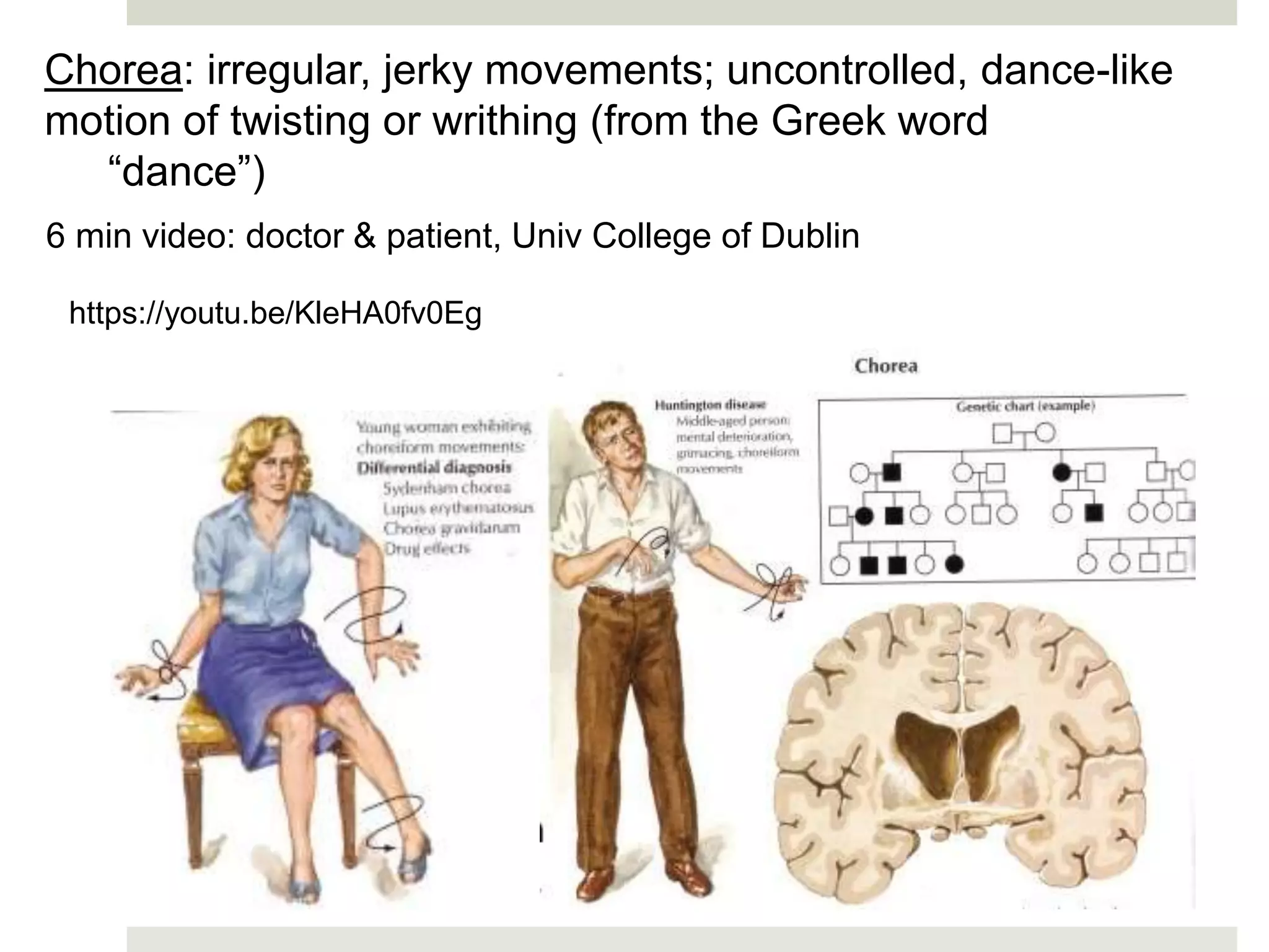 Huntington's Disease-.ppt
