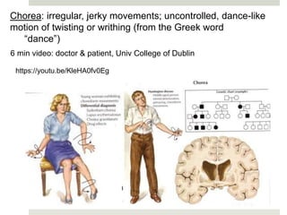 Huntington's Disease-.ppt
