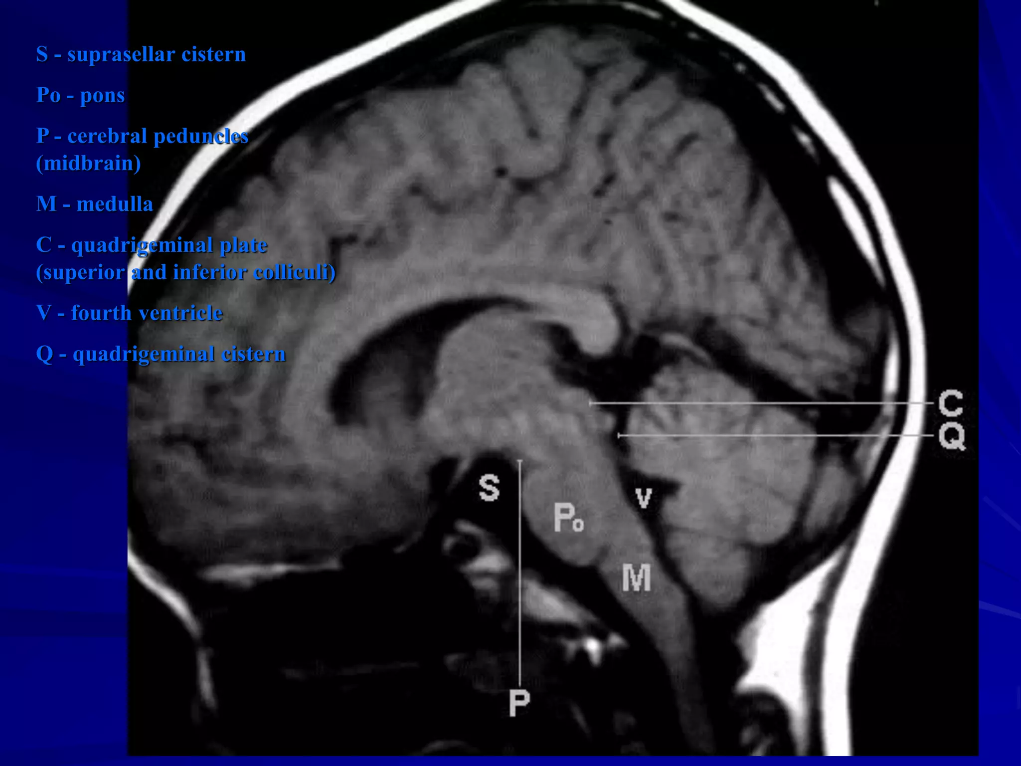 Huong dan doc ctscan so nao | PDF