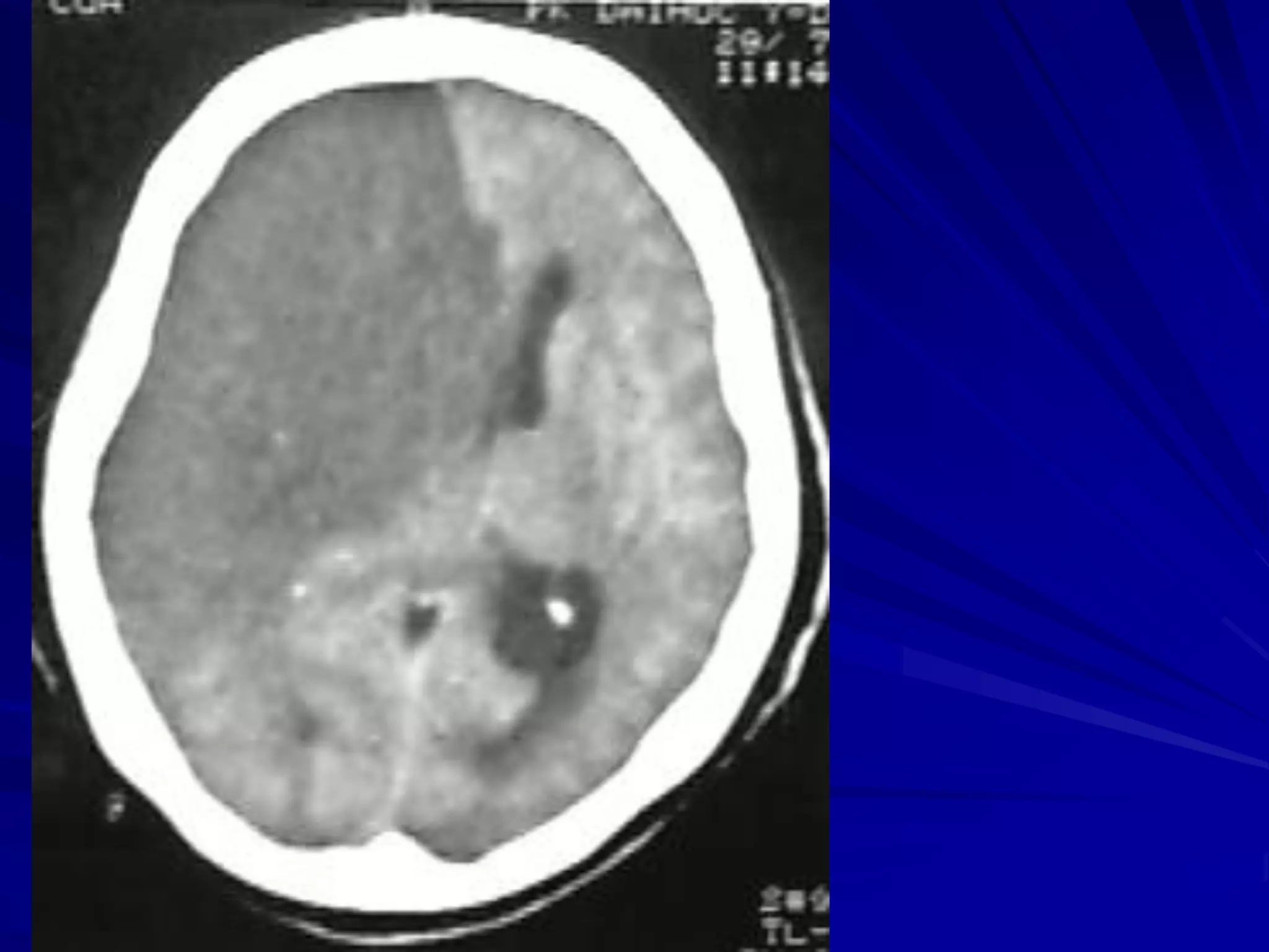 Huong dan doc ctscan so nao | PDF