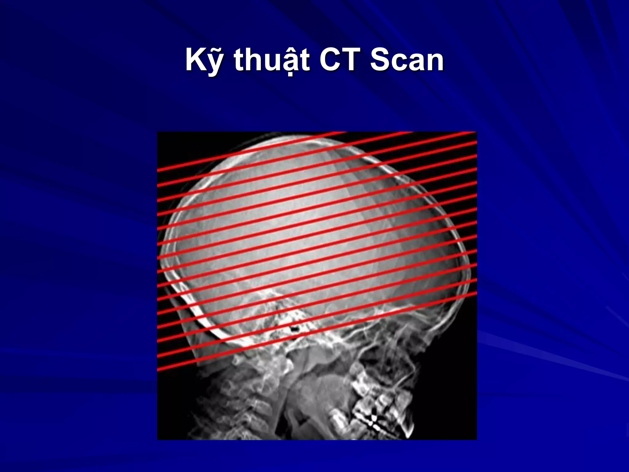 Huong dan doc ctscan so nao | PDF